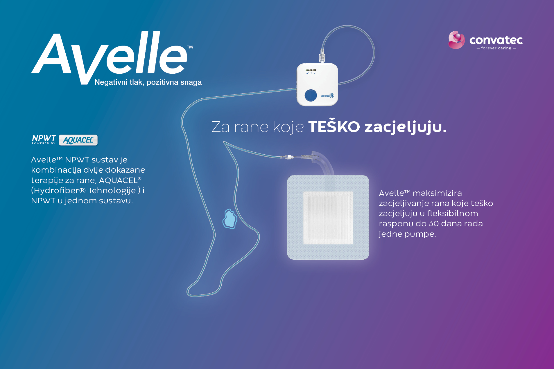 Avelle™ NPWT sustav